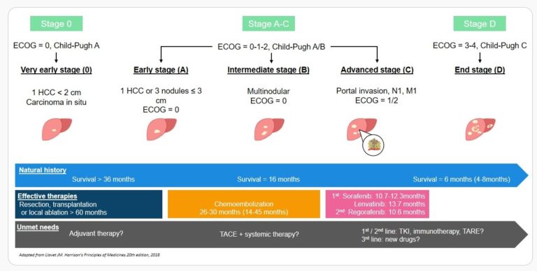 Primary Liver Cancers – Genoscience Pharma
